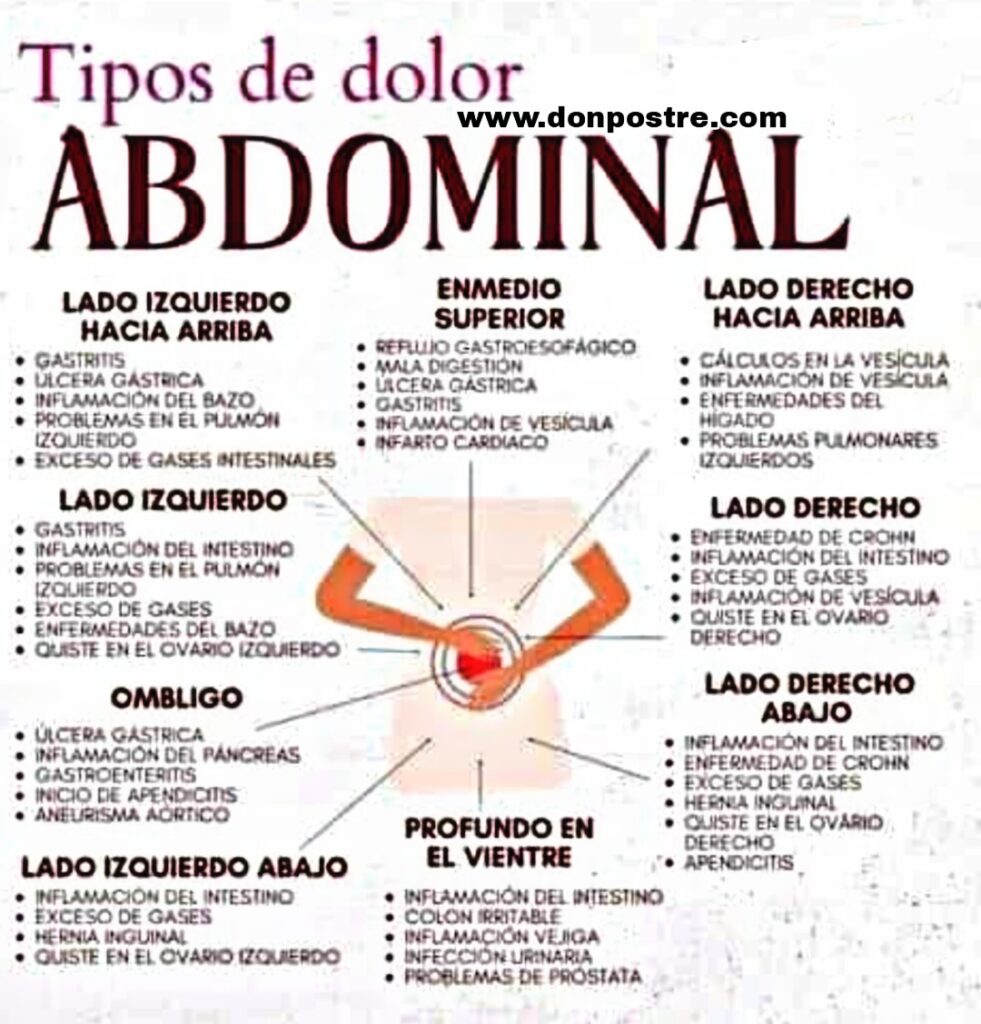 Don Postre » Blog Archive » Tipos de dolor abdominal